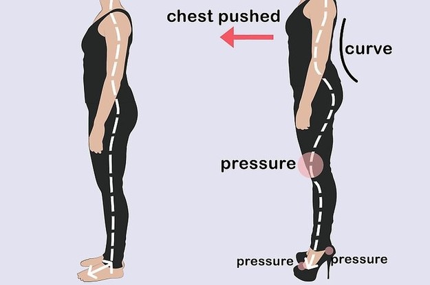 heels posture - Precision Chiropractic